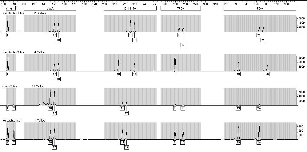 Achtergrond van het DNA-onderzoek_hoe wordt DNA onderzocht?